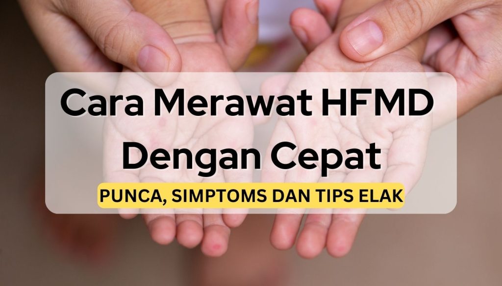 Cara Merawat HFMD Dengan Cepat : Simptom, Cara dan 7 Tips untuk elak.